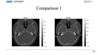 Denoising Unpaired Low Dose CT Images with Self-Ensembled CycleGAN | PPTX