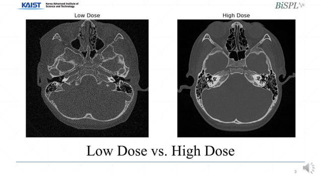 Denoising Unpaired Low Dose CT Images with Self-Ensembled CycleGAN | PPTX | Computing ...