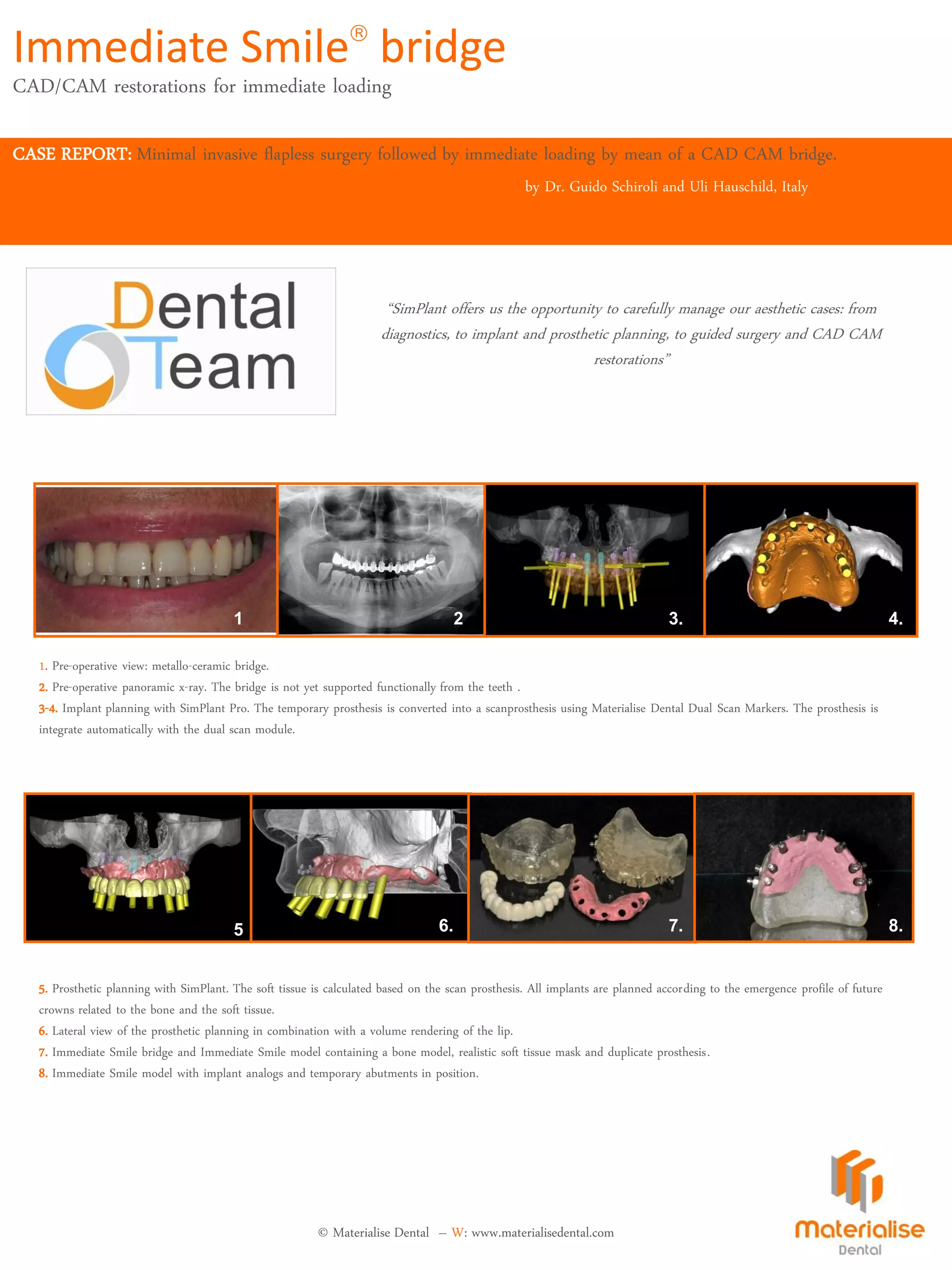 Immediate Smile bridge: Minimal invasive flapless surgery followed by ...