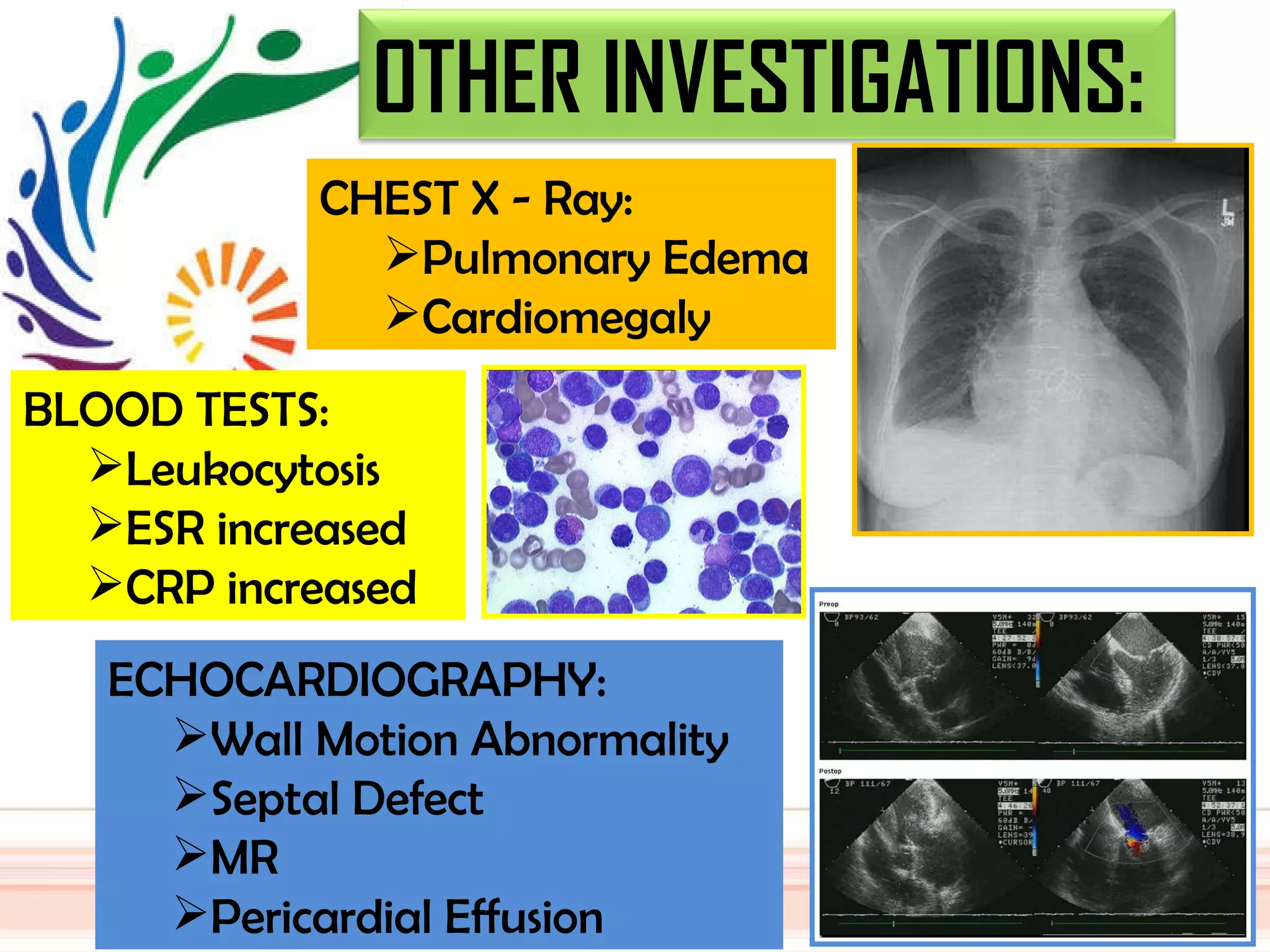 Ischemic heart disease, IHD, ihd, ischemic heart disease ischaemic ...