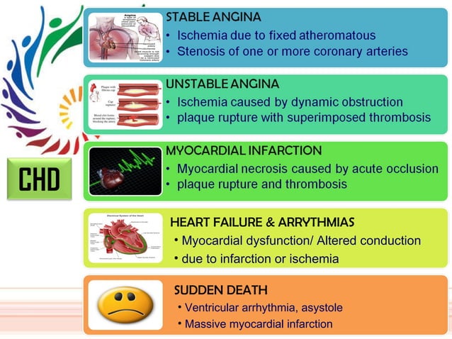 Ischemic heart disease, IHD, ihd, ischemic heart disease ischaemic ...