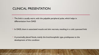 Ischaemic Monomelic Neuropathy (IMN).pptx