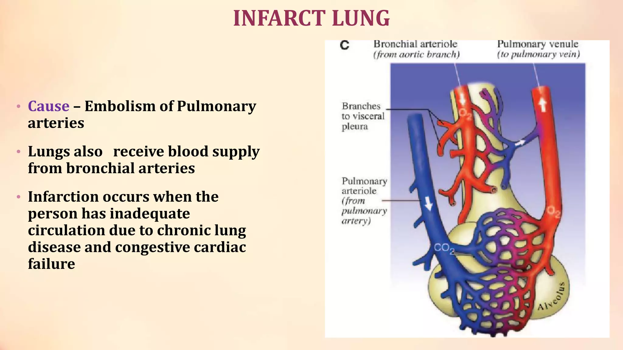 ischemia-and-infarction.ppt