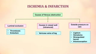 ischemia-and-infarction.ppt