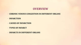 ischemia-and-infarction.ppt