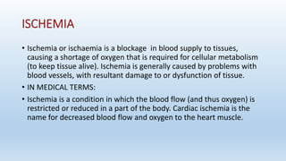 Ischemia 044 | PPTX