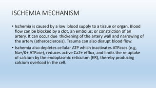 Ischemia 044 | PPTX