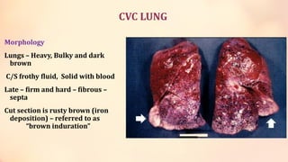 ischemia and infarction.pdf