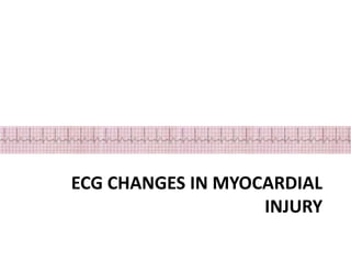 ECG changes in myocardial Ischemia and injury | PPTX