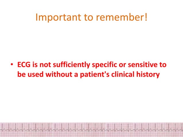 ECG changes in myocardial Ischemia and injury | PPTX | Heart and ...