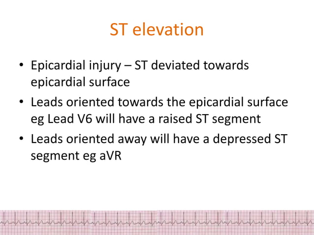 ECG changes in myocardial Ischemia and injury | PPT