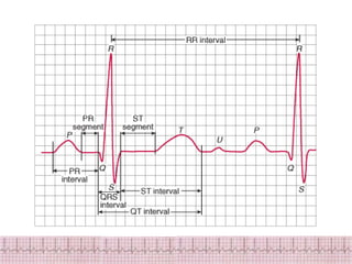 ECG changes in myocardial Ischemia and injury | PPTX