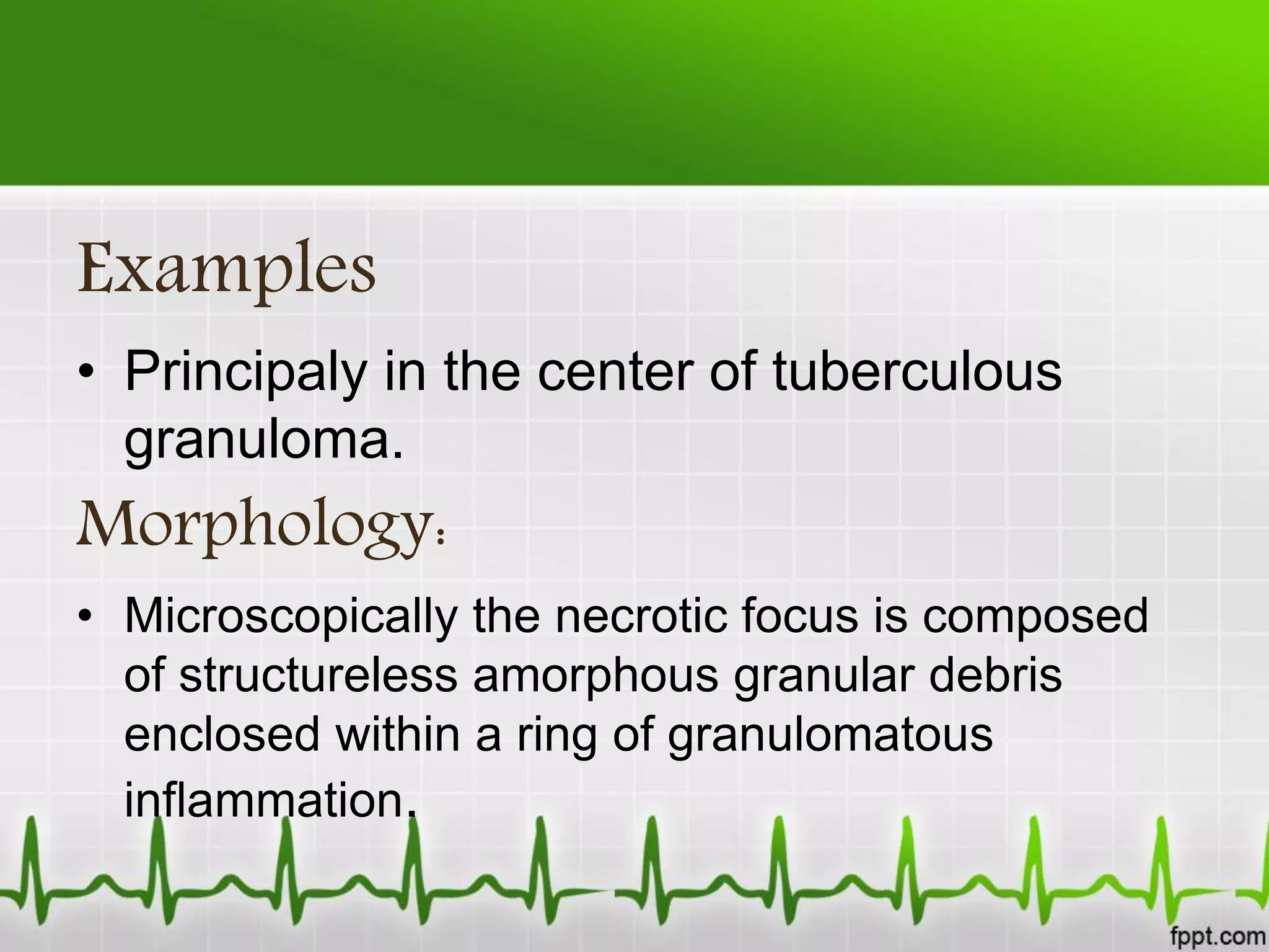 Ischemia,necrosis,hypoxia | PDF