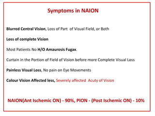 Ischemic of optic neuropathy, Optic Neuropathy (Ischemic), Eye Stroke ...