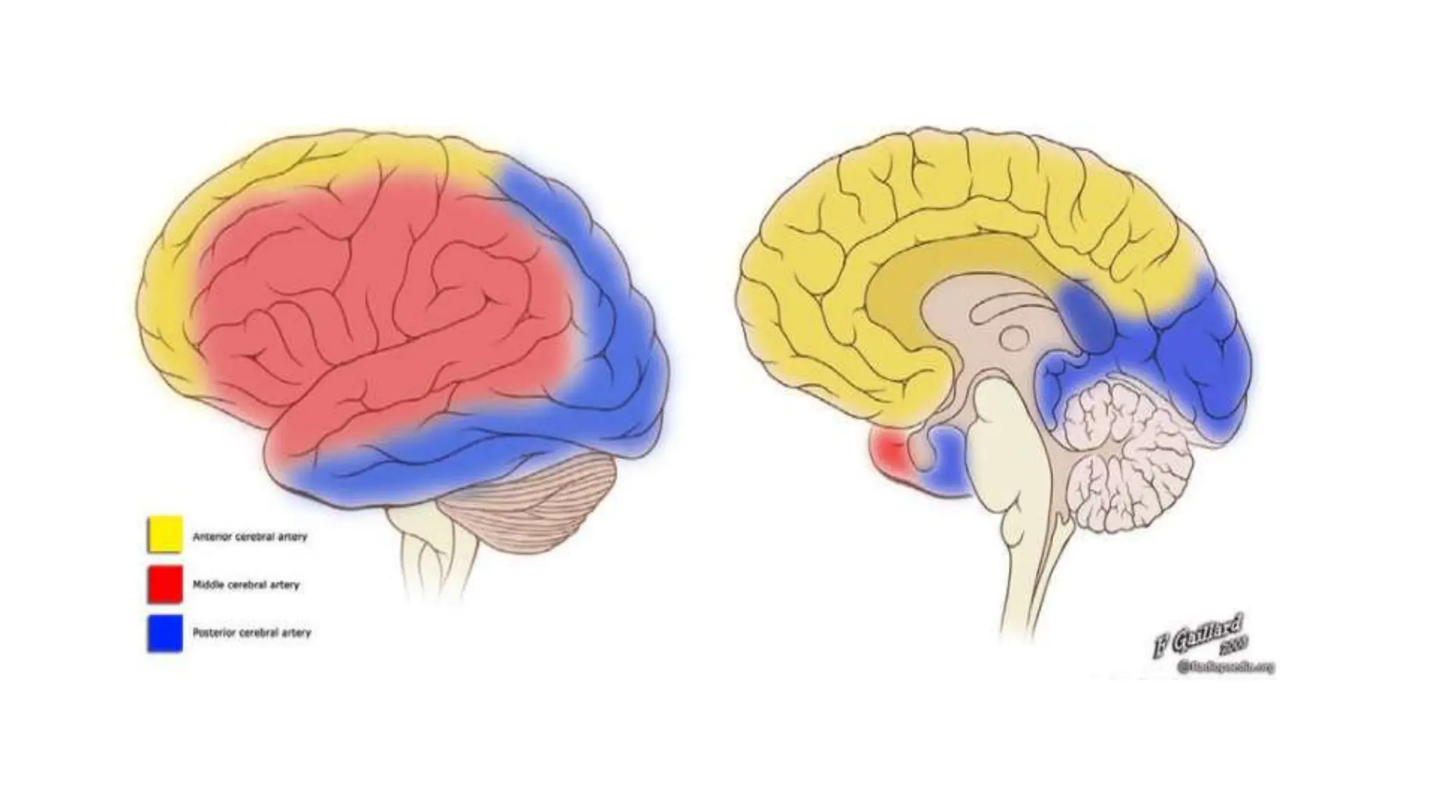 Ischaemic stroke pathogenesis and treatment | PPTX | Brain and Nervous ...
