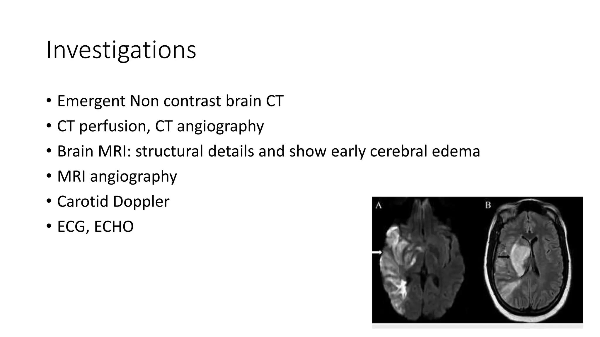 Ischaemic stroke pathogenesis and treatment | PPTX | Brain and Nervous ...