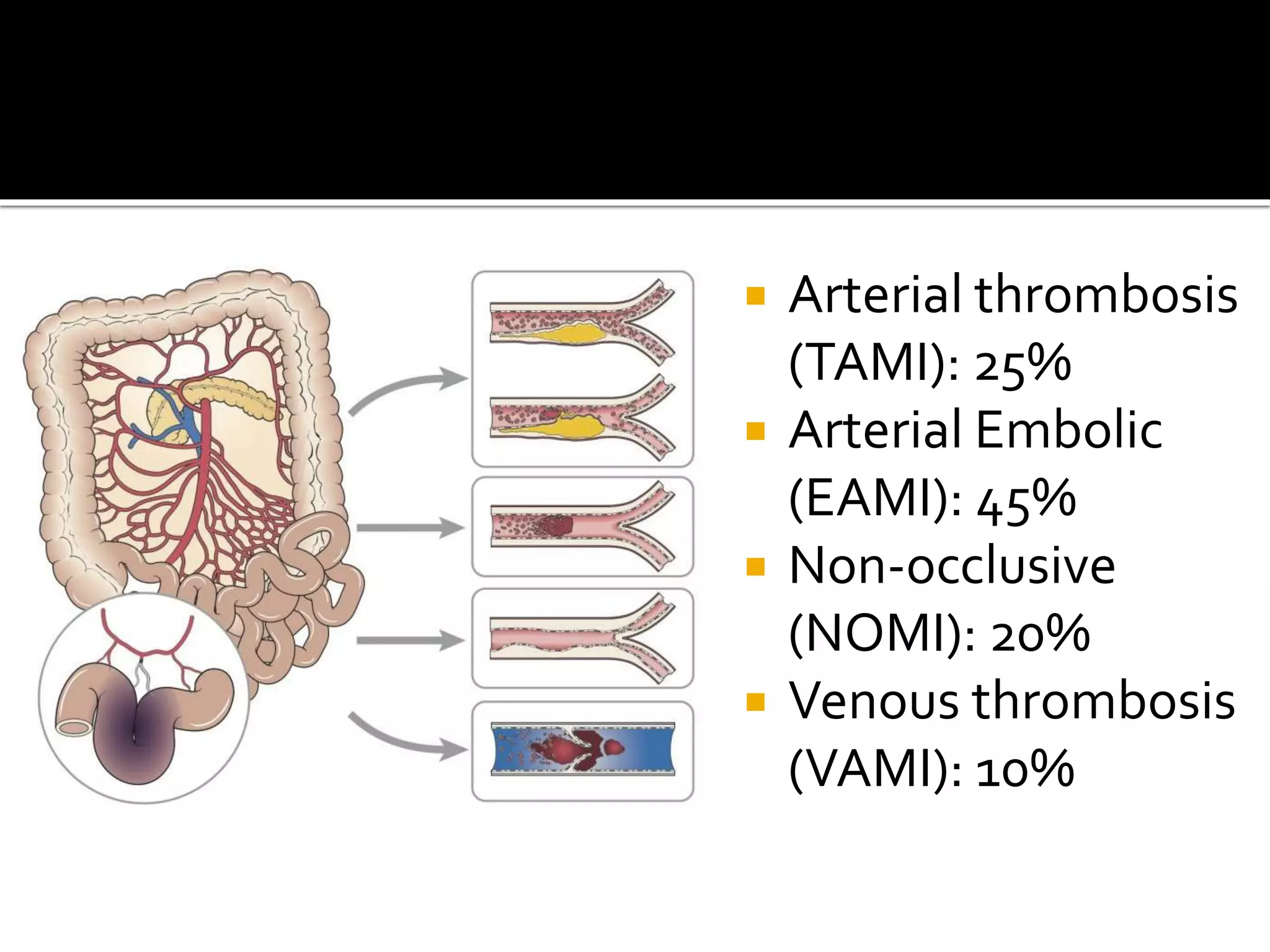Guideline: Acute mesenteric ischemia | PPTX