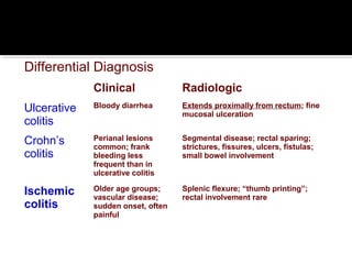 Ischemic colitis | PPT
