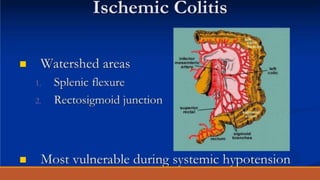 Ischemic colitis medical condition .pptx