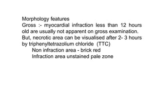 Ischemic Heart Disease.pptx