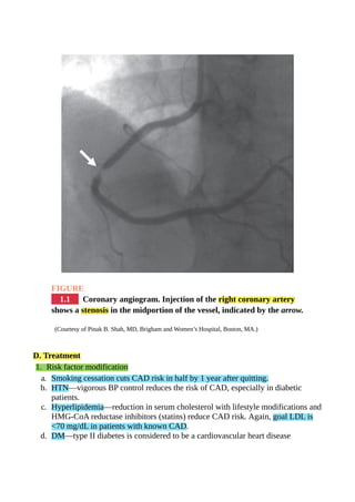 Ischemic Heart Disease - Stable Angina Pectoris.pdf