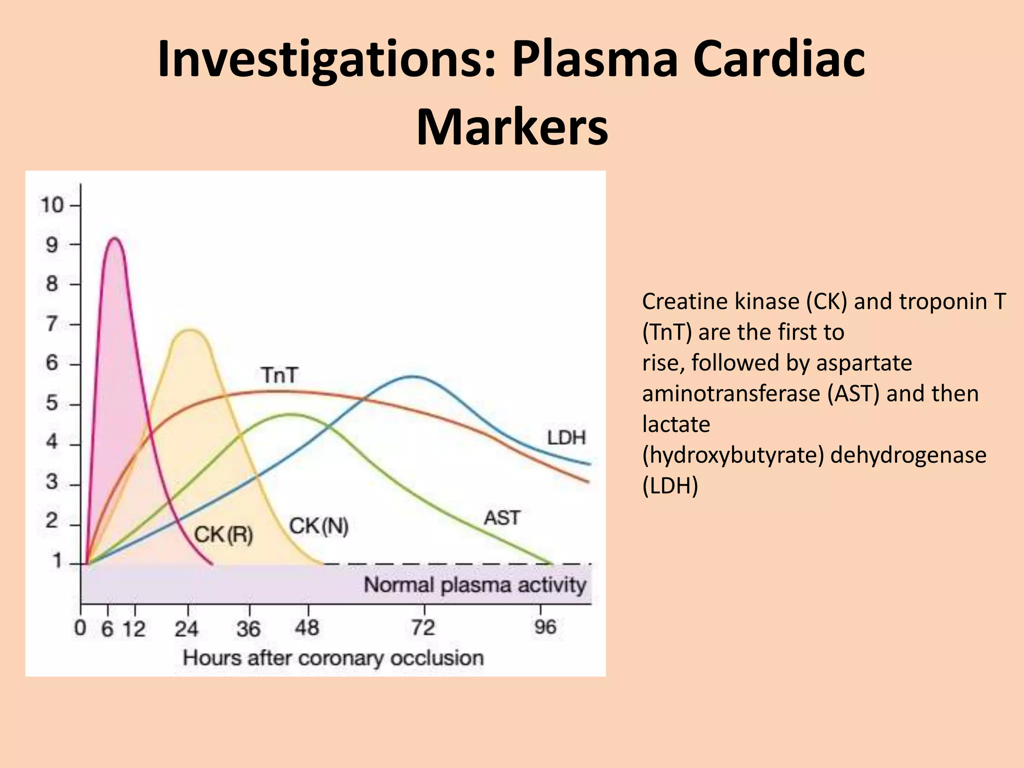 Ischemic heart disease | PPTX