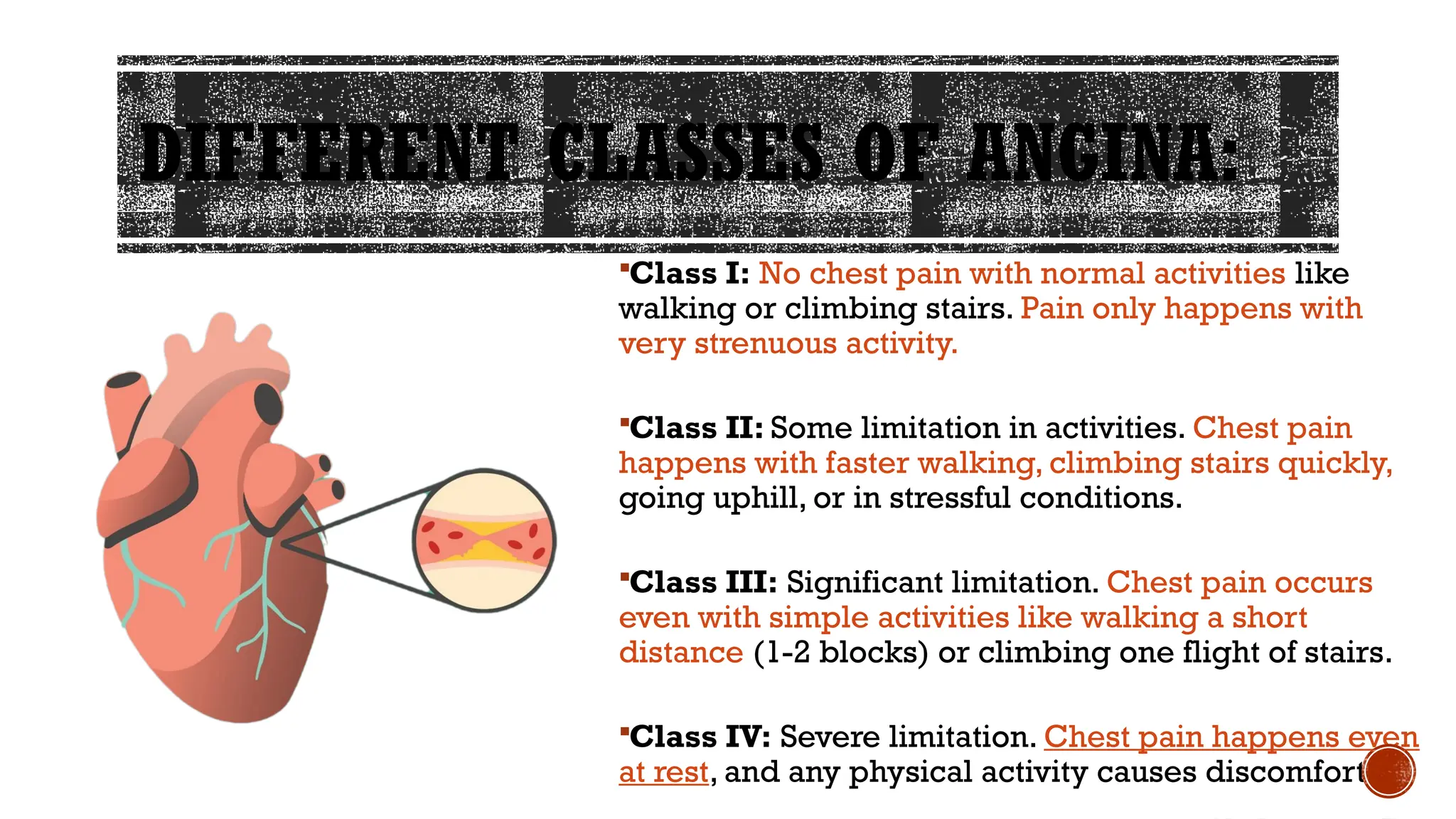 (ischemic heart disease) Angina by Jewel.pptx