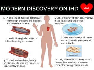 Ischemic heart disease final | PPTX