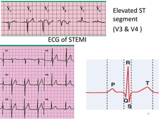 Ischemic Heart Disease for MSc nurses.pptx