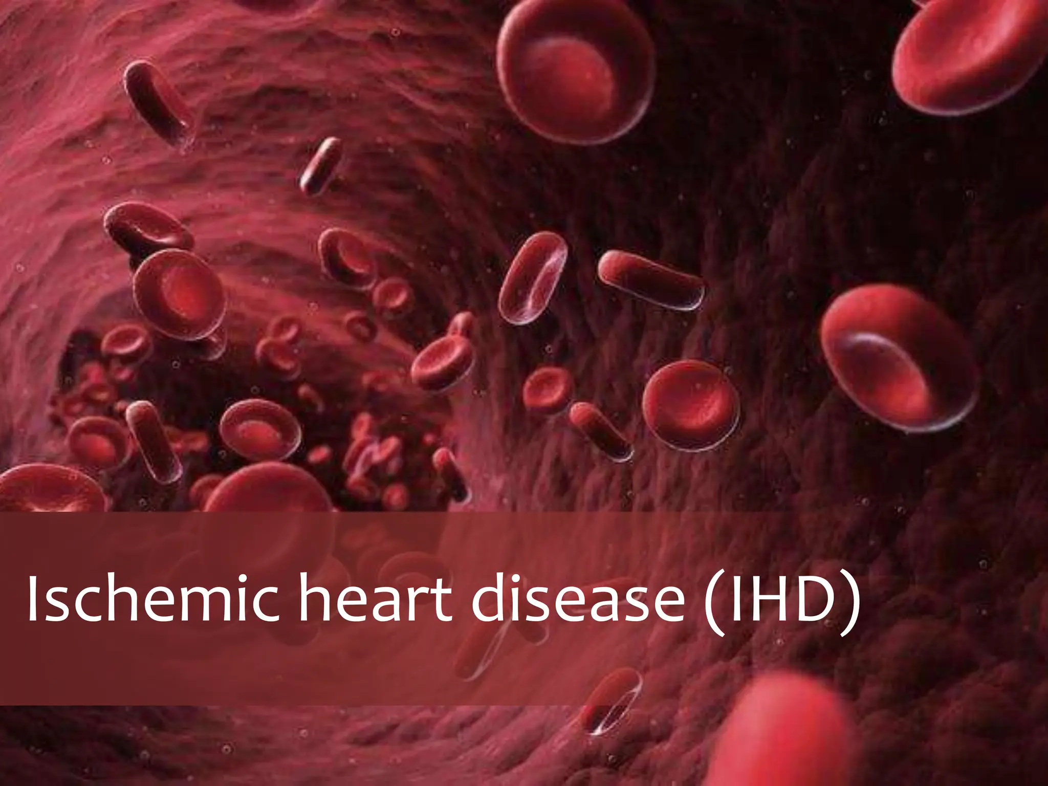 Ischemic heart disease (IHD) pathophysiology , types , its causes and ...