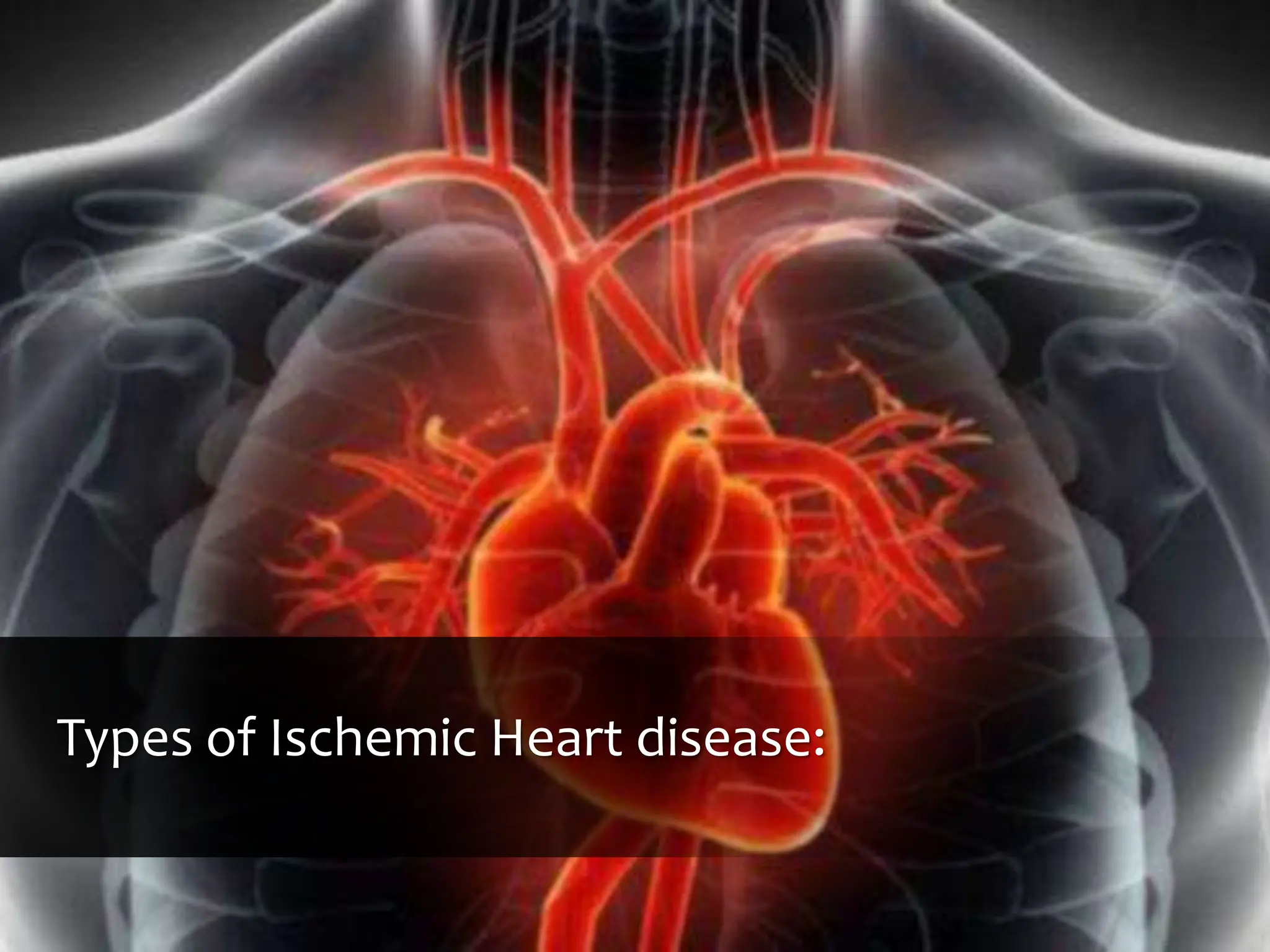 Ischemic heart disease (IHD) pathophysiology , types , its causes and ...