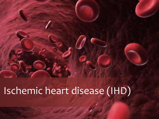 Ischemic heart disease (IHD) pathophysiology , types , its causes and ...