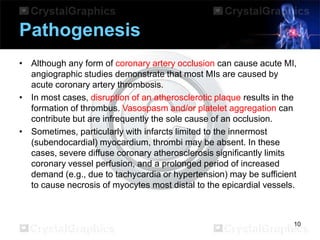 Ischemic heart disease_Myocardial infarction_ | PPTX