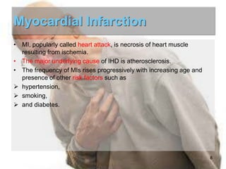 Ischemic heart disease_Myocardial infarction_ | PPTX