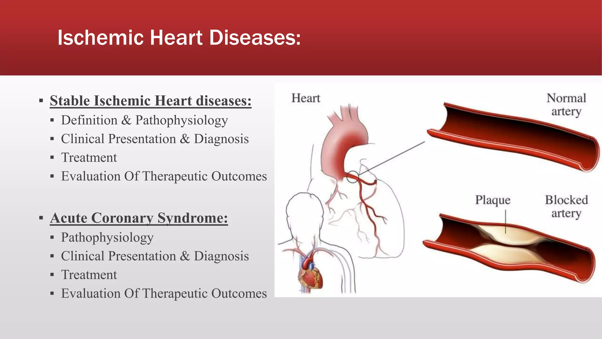 Ischemic Heart Diseases.pptx