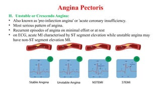 Ischemic Heart Diseases-Angina pectoris.pptx