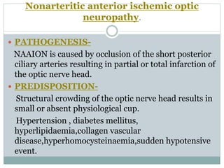 ISCHEMIC OPTIC NEUROPATHIES.pptx