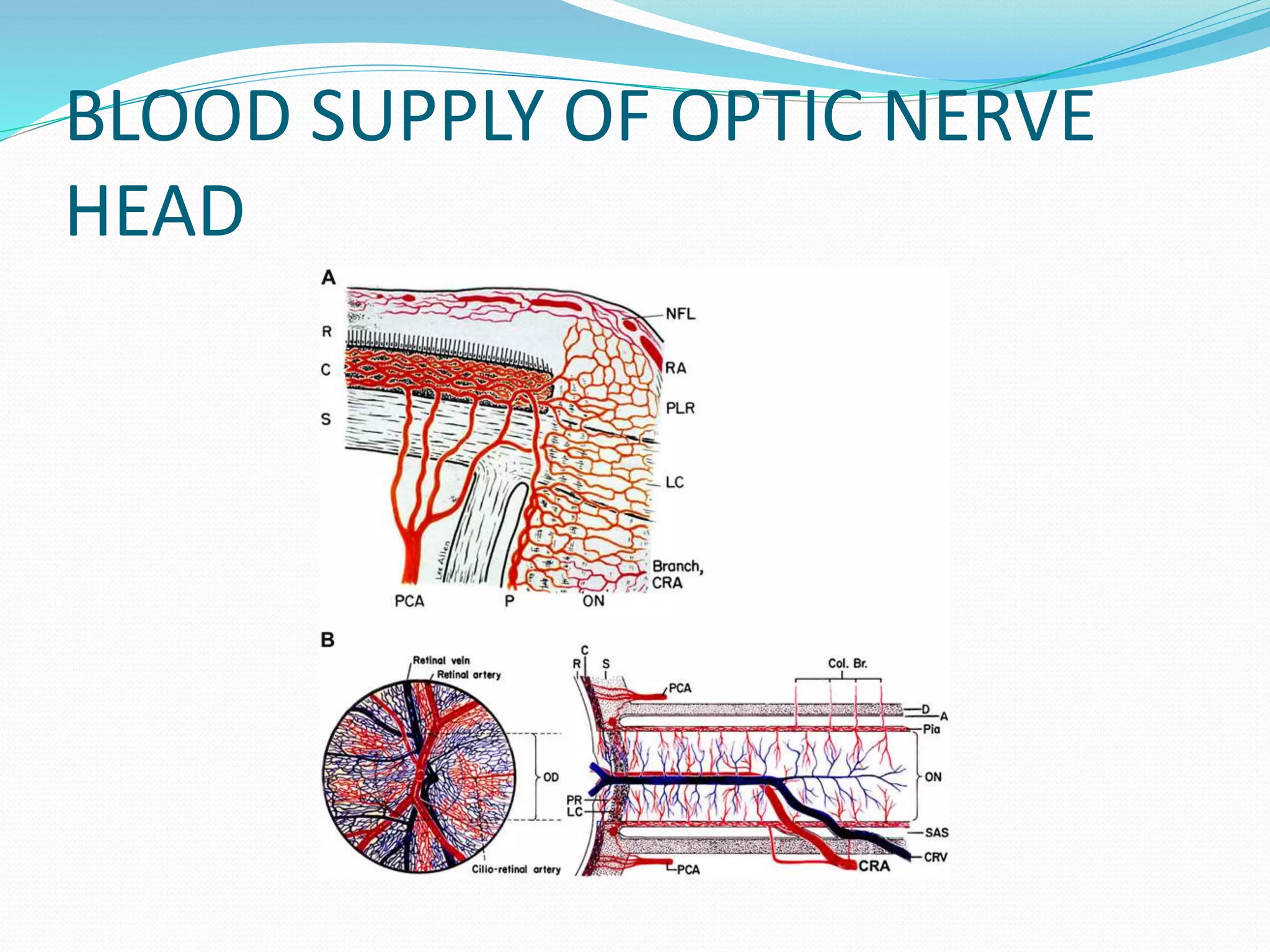 Ischemic optic neuropathy | PPTX