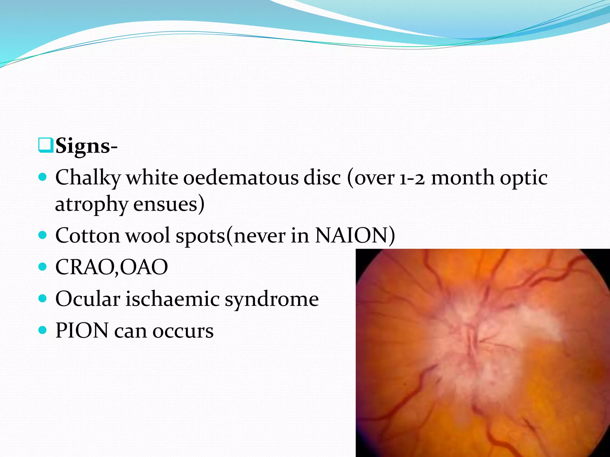 Ischemic optic neuropathy | PPTX