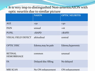 Ischemic optic neuropathy | PPTX