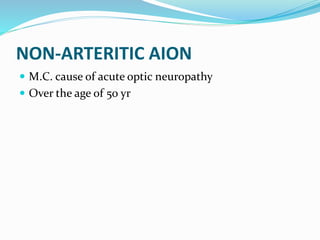 Ischemic optic neuropathy | PPTX