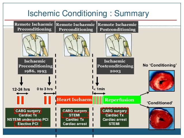 Ischemic preconditioning