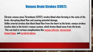 Ischemic Stroke pptx for education purpose | PDF