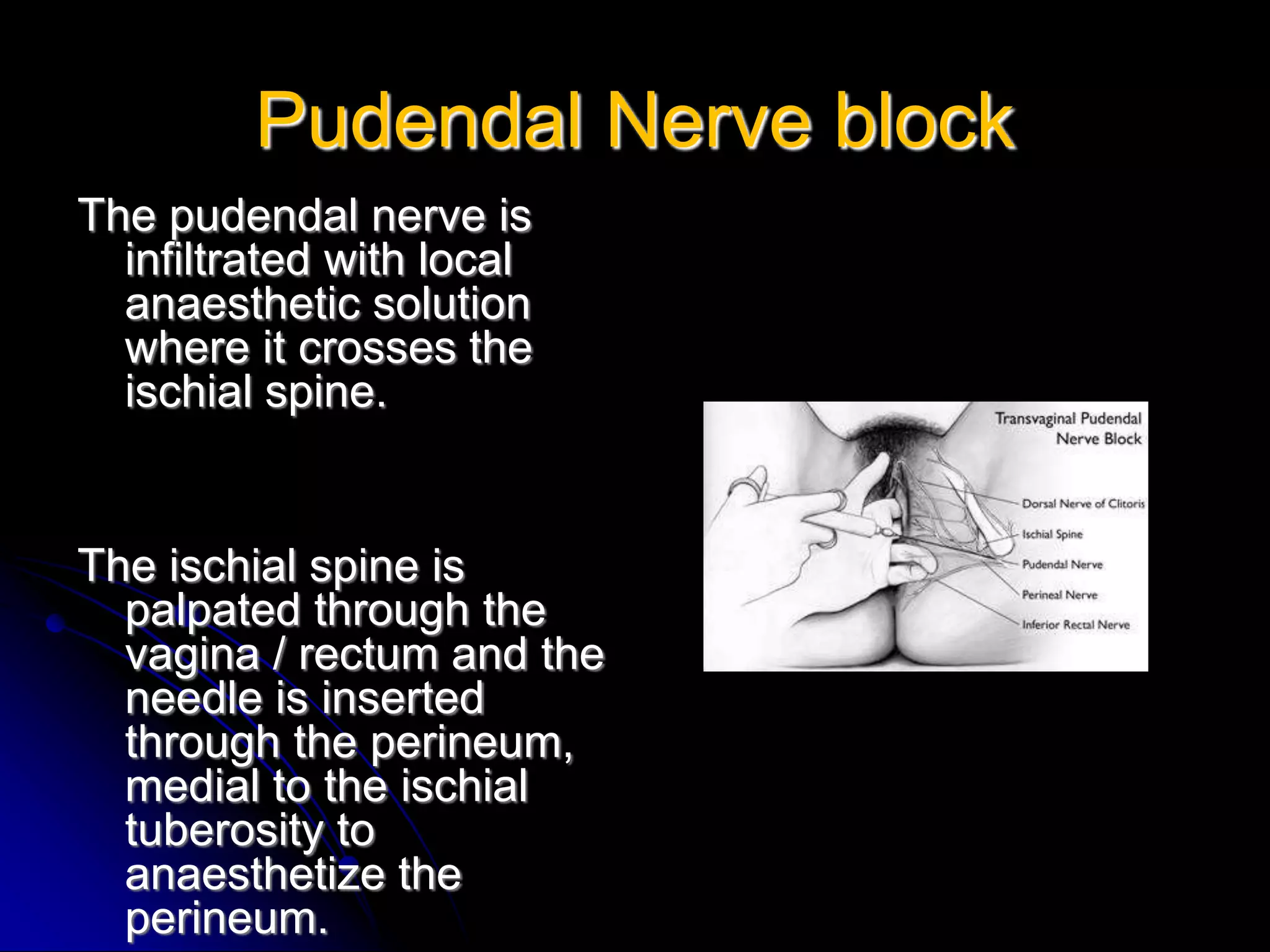 Ischiorectal-fossa.ppt