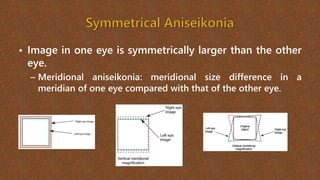 Iseikonic Lenses.pptx