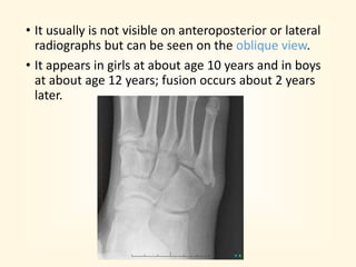 Iselin's disease | PPTX