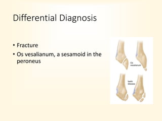 Iselin's disease | PPTX