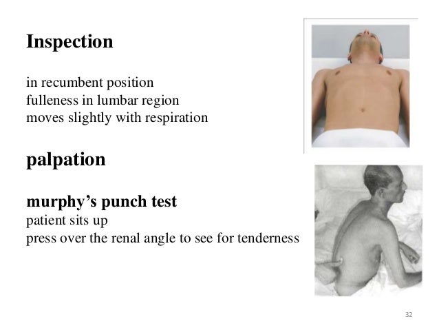 RENAL ANATOMY & RENAL CELL CANCERS