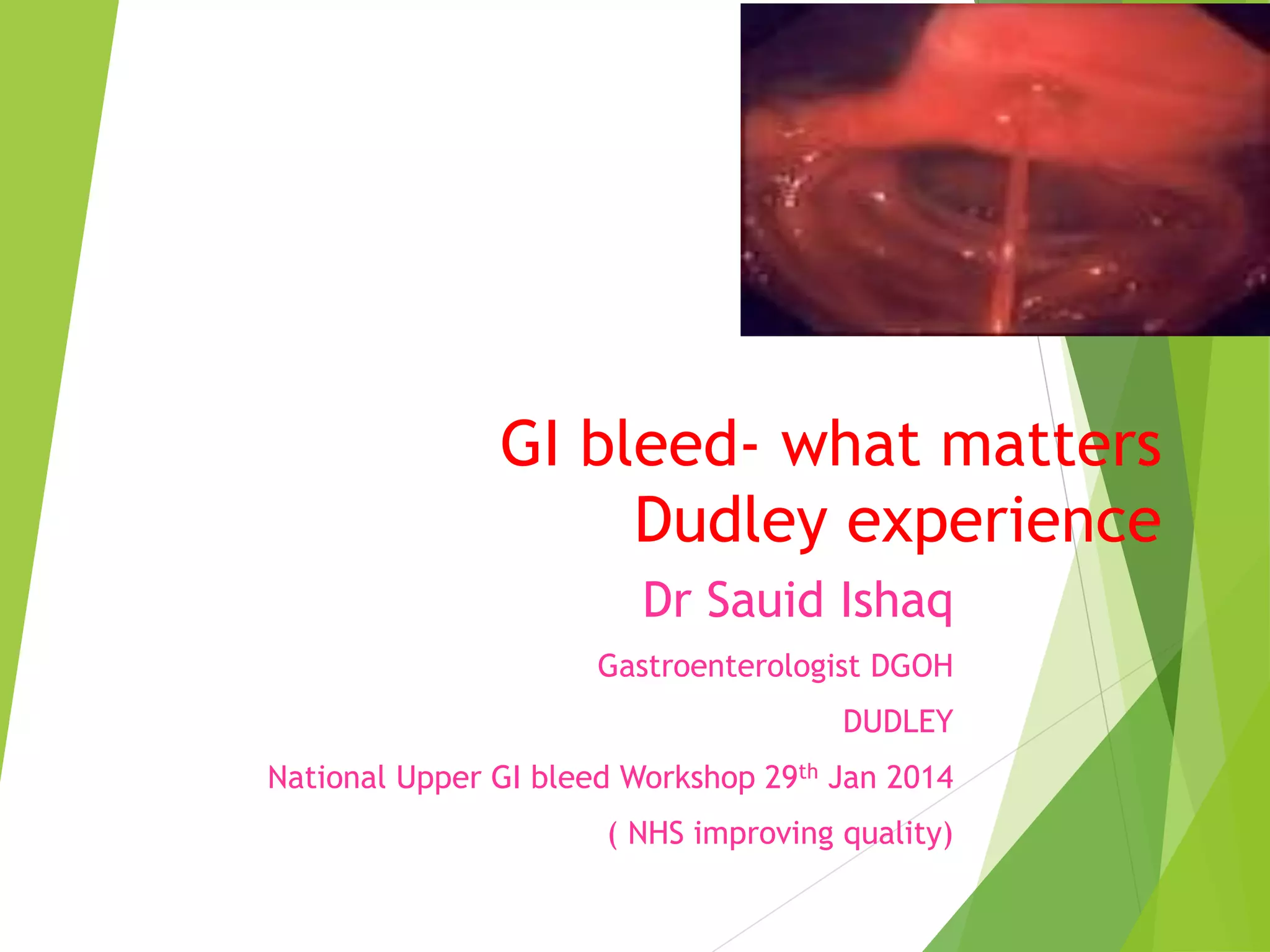 Prof Sauid Ishaq - acute upper GI bleed service Dudley | PDF
