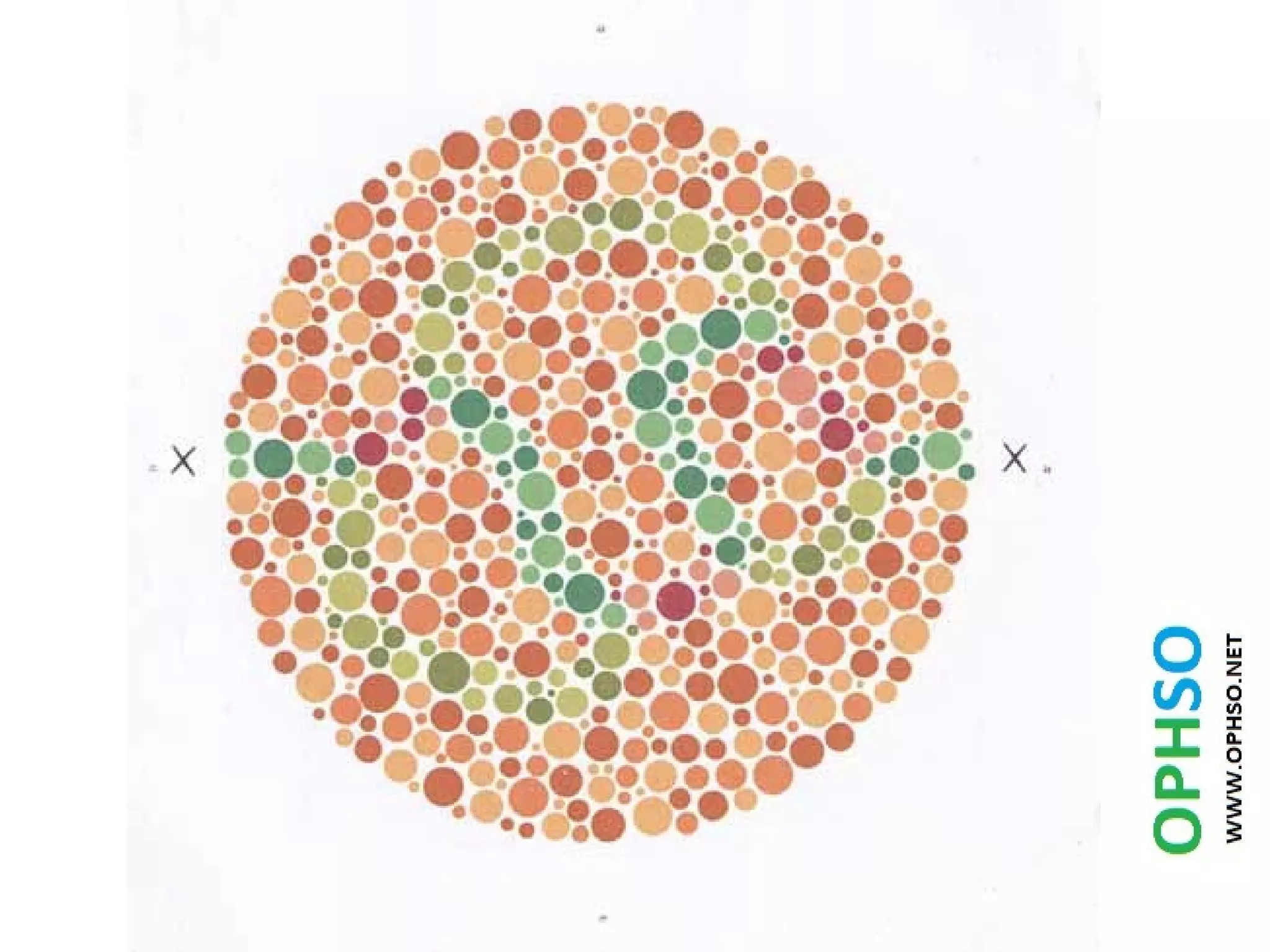 Ishihara test | PPT